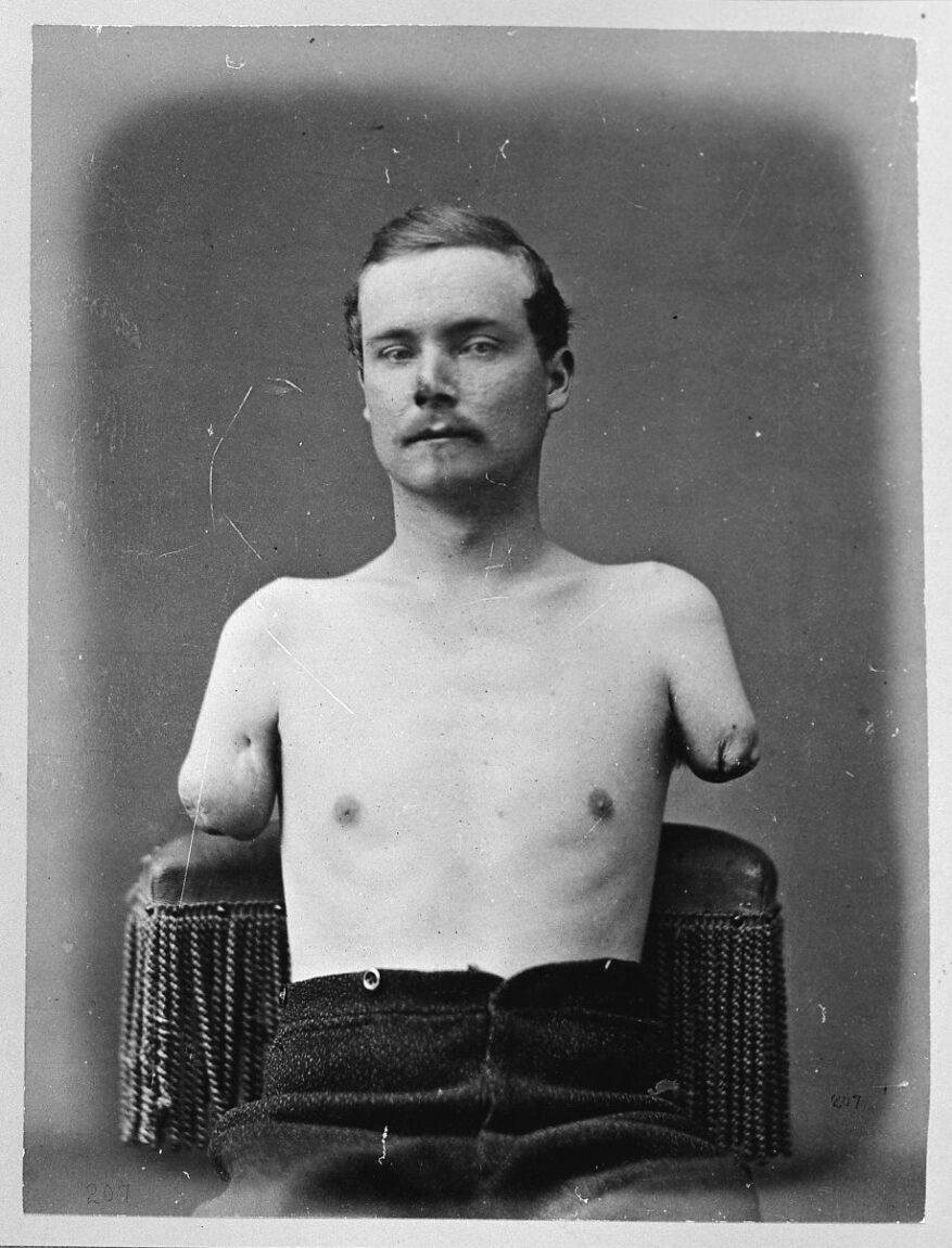 Healers or Horrors: Civil War Medicine - Warfare History Network